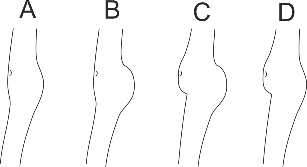 Úprava střihu na legíny pro další typy postav – Caramilla.cz